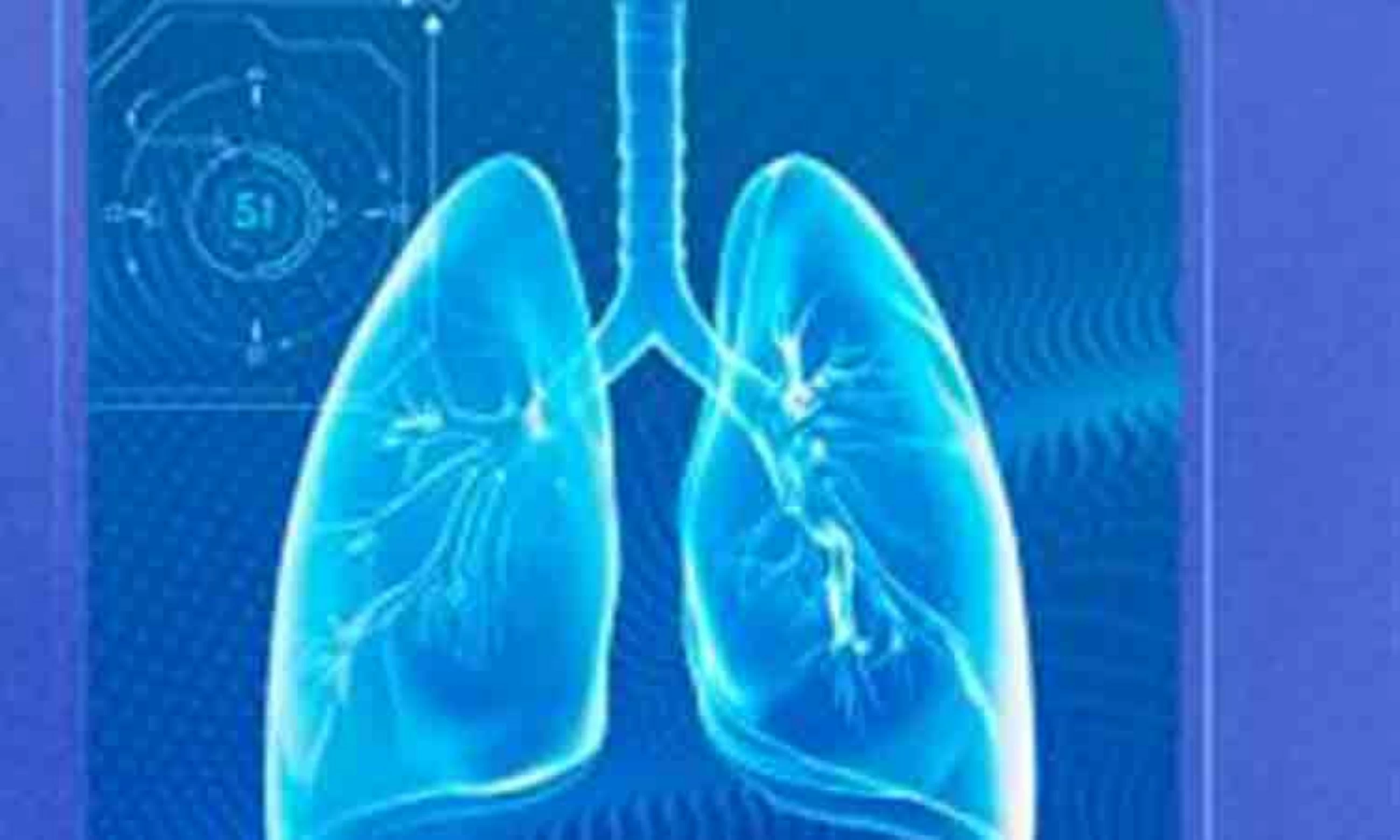 UAE approves innovative treatment for idiopathic pulmonary fibrosis